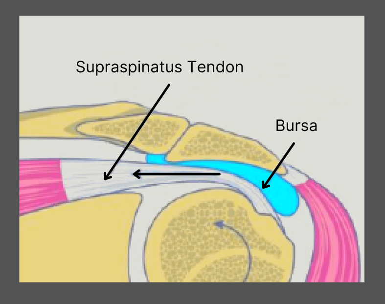 Shoulder Impingement Guide | Easthill Physiotherapy & Acupuncture